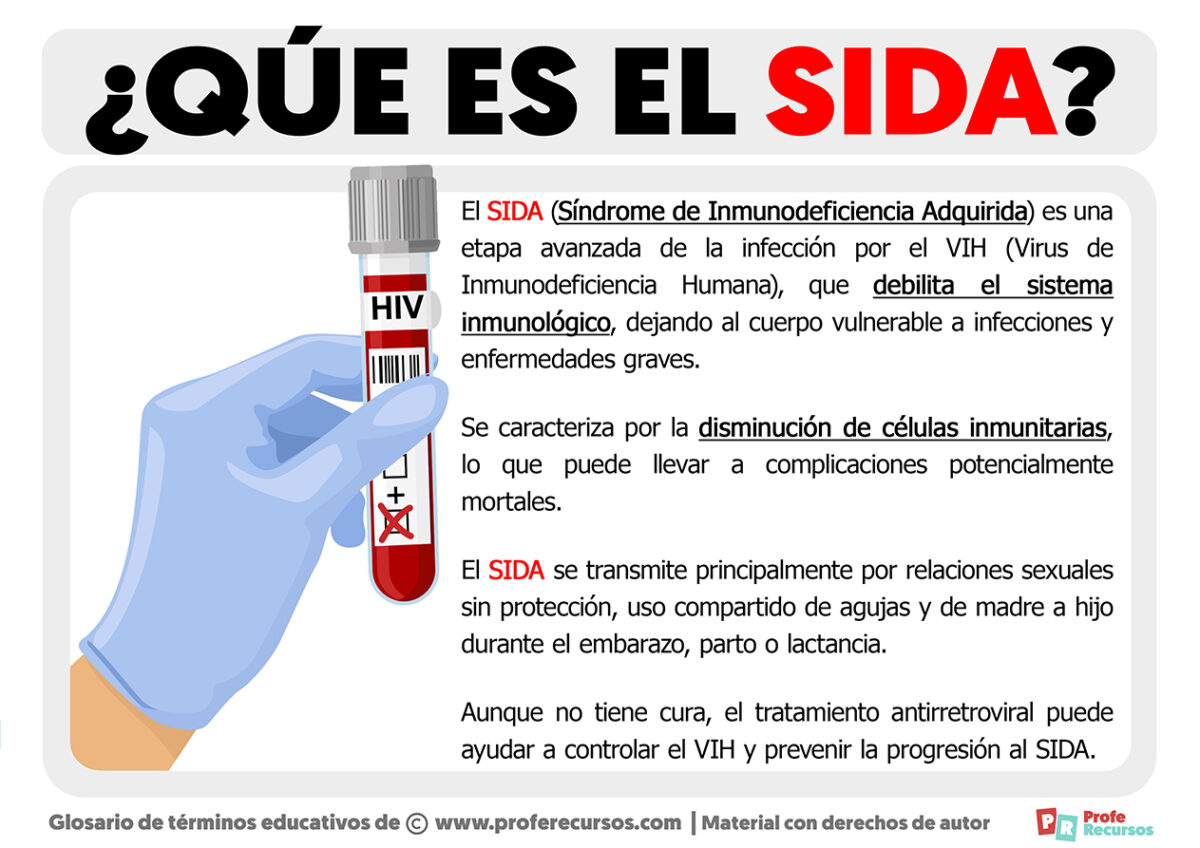 Qué es el SIDA | Definición de SIDA