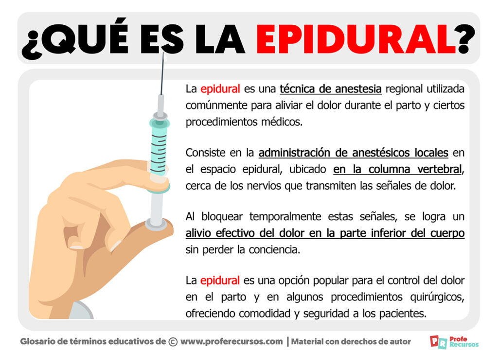 Qué es la Epidural | Definición de Epidural