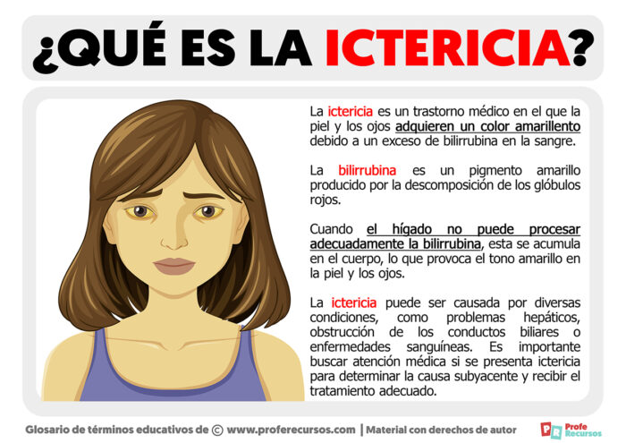 Qué es la Ictericia | Definición de Ictericia