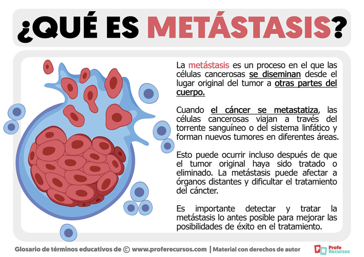 Qué es Metástasis | Definición de Metástasis
