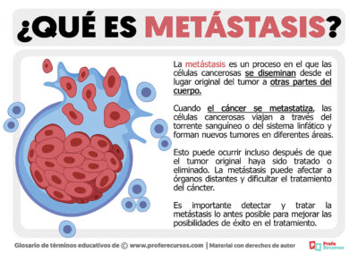 Qué es Metástasis | Definición de Metástasis