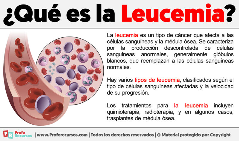 Qué es la Leucemia | Definición de Leucemia