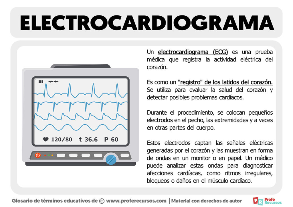 Qué Es Un Electrocardiograma