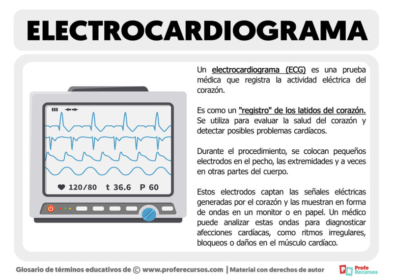 Qué es un Electrocardiograma