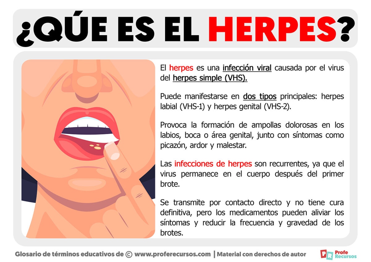 Qué es el Herpes | Definición de Herpes