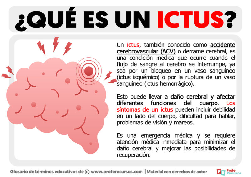 Qué es un Ictus | Definición de Ictus