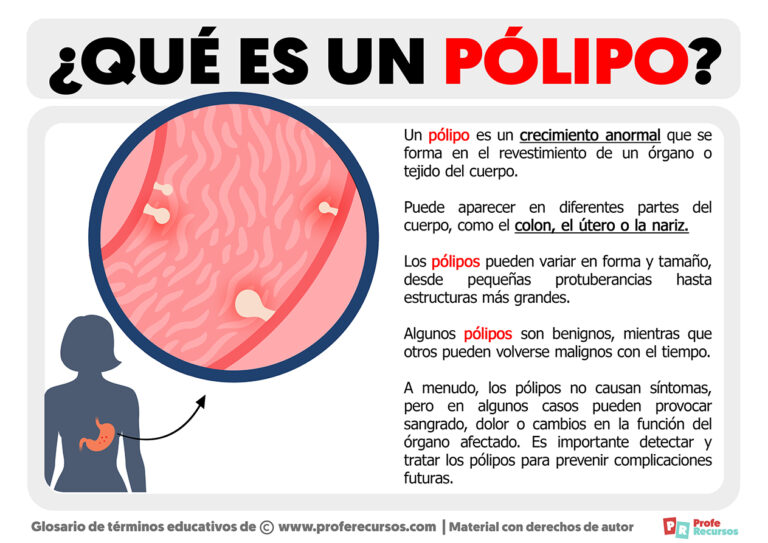 Qué es un Pólipo | Definición de Pólipo