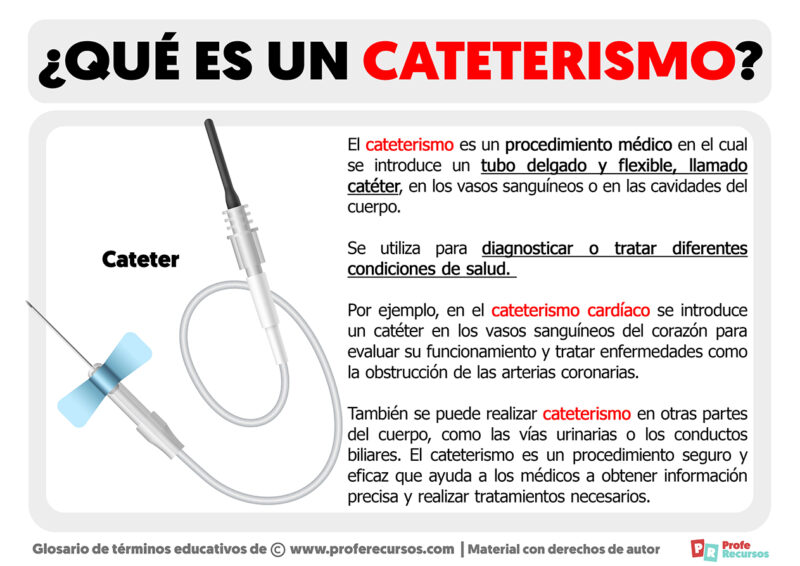 Qué es un Cateterismo | Definición de Cateterismo