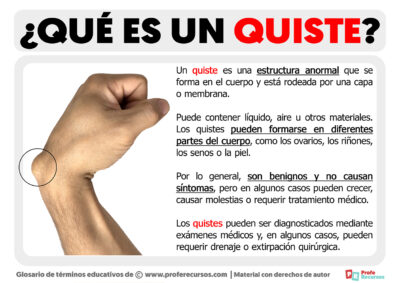 Qué es un Quiste | Definición de Quiste