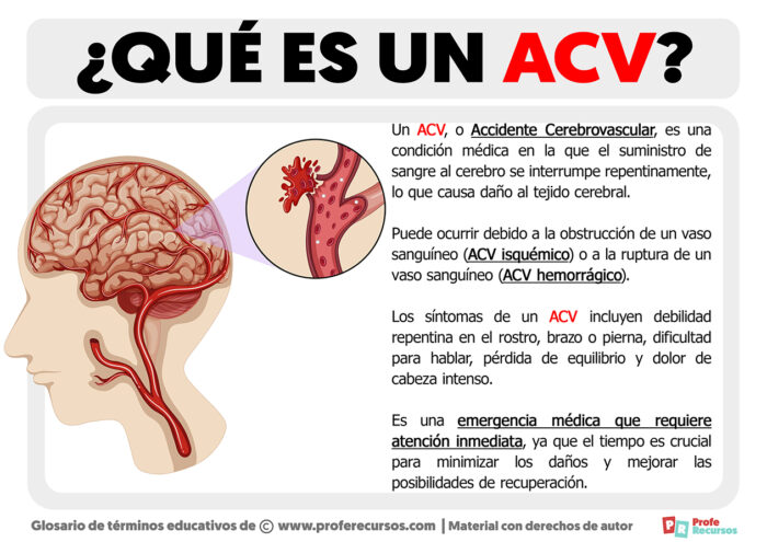 Qué es una ACV | Definición de ACV
