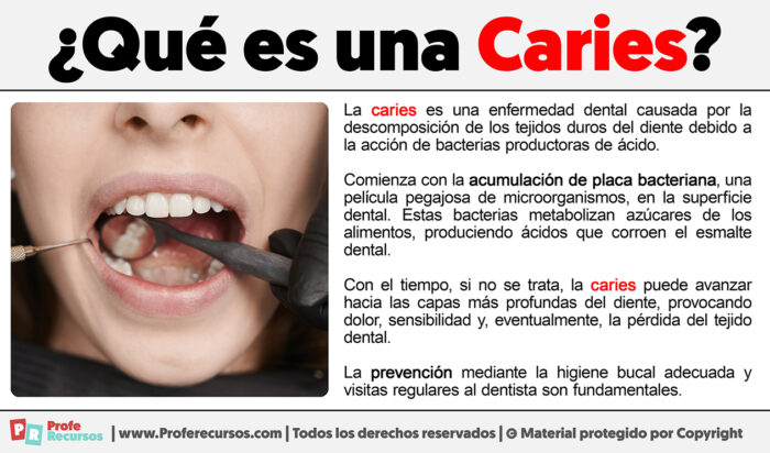 Qué es una Caries | Definición de Caries