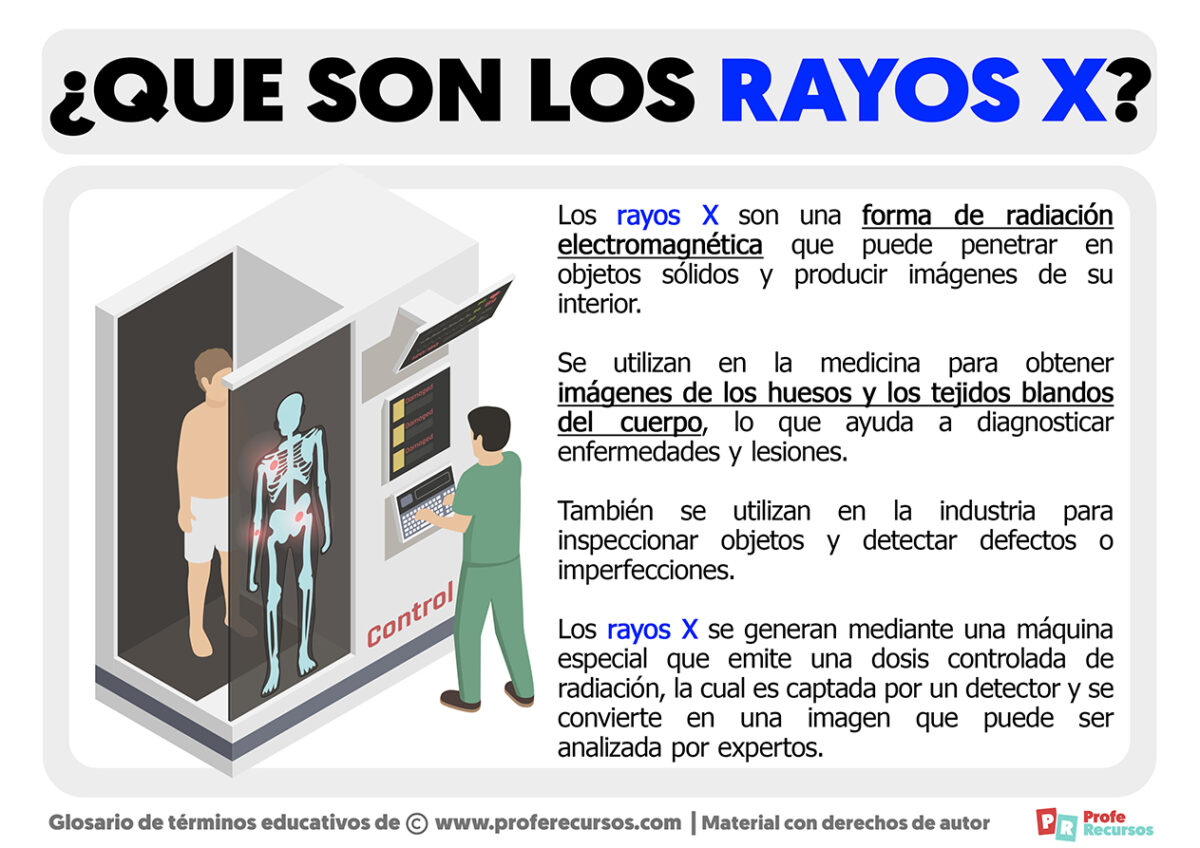 Que son los Rayos X | Definición de Rayos X